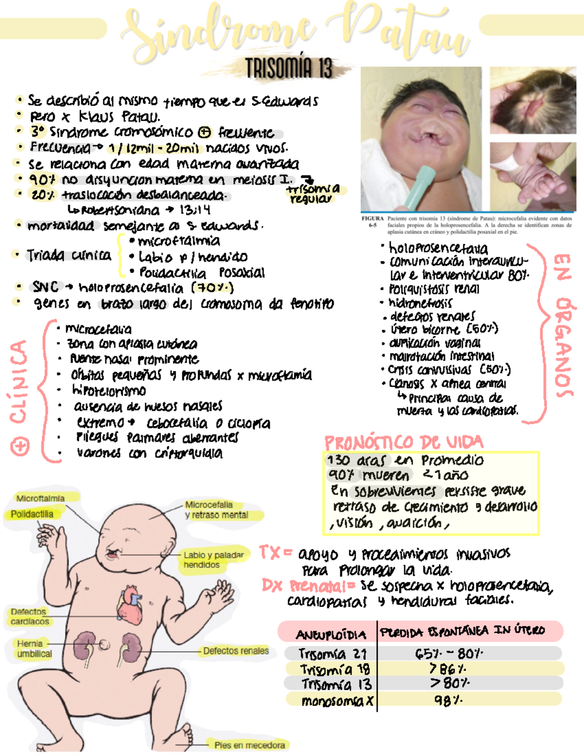 Síndrome Patau - Genetica y sindromes - Se describió al mismo tiempo ...