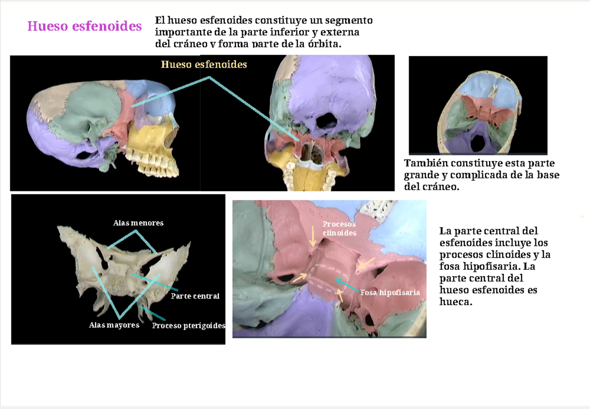 4.2.5 Hueso esfenoides, huesos restantes de la cara, tipeo acland ...