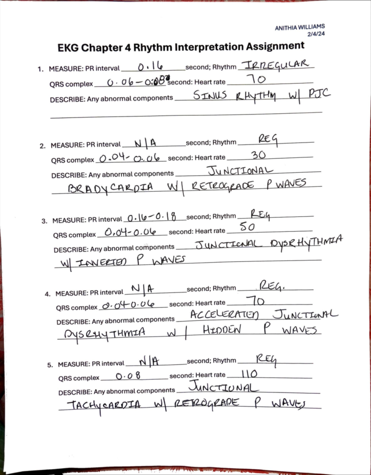 CH. 4 EKG ASS - EKG assignment - EMSP 1010 - Studocu