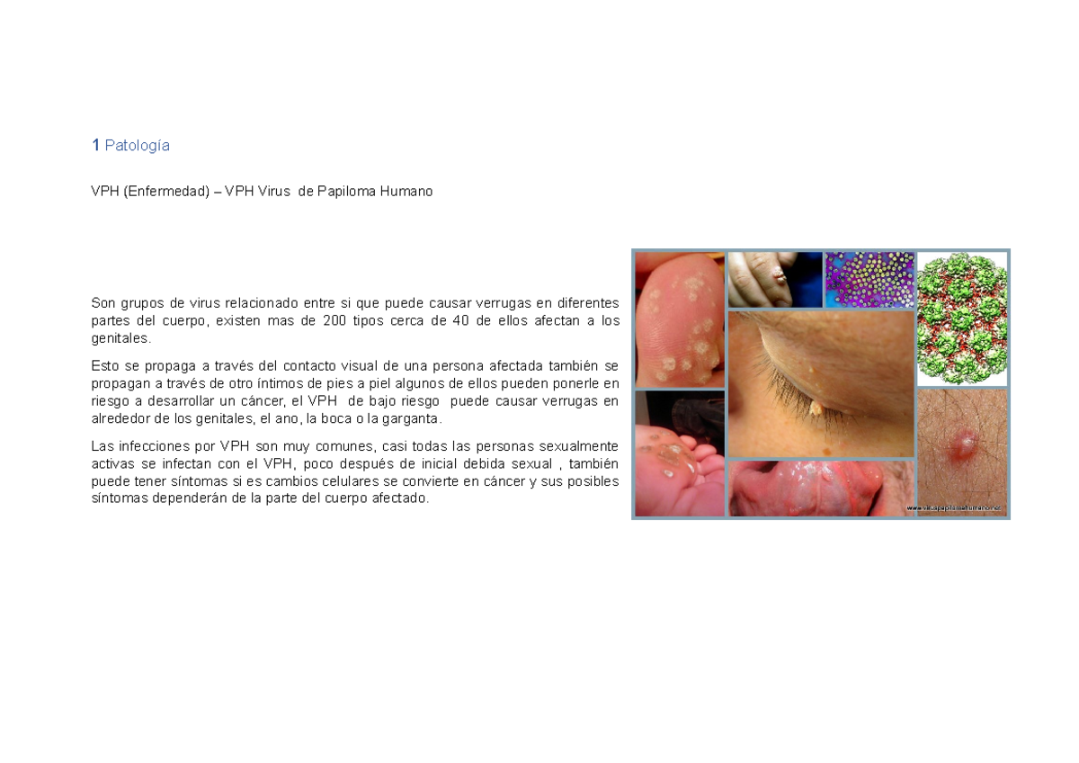 CASO Clínico - caso clinico - 1 Patología VPH (Enfermedad) – VPH Virus ...