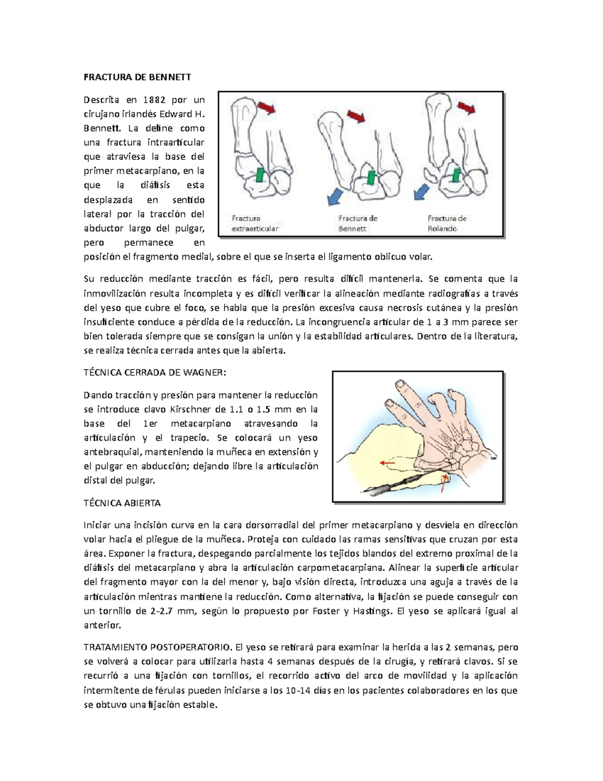 Fractura DE Bennett y Rolando TRAUMATOLOGÍA Y ORTOPEDIA - FRACTURA DE ...