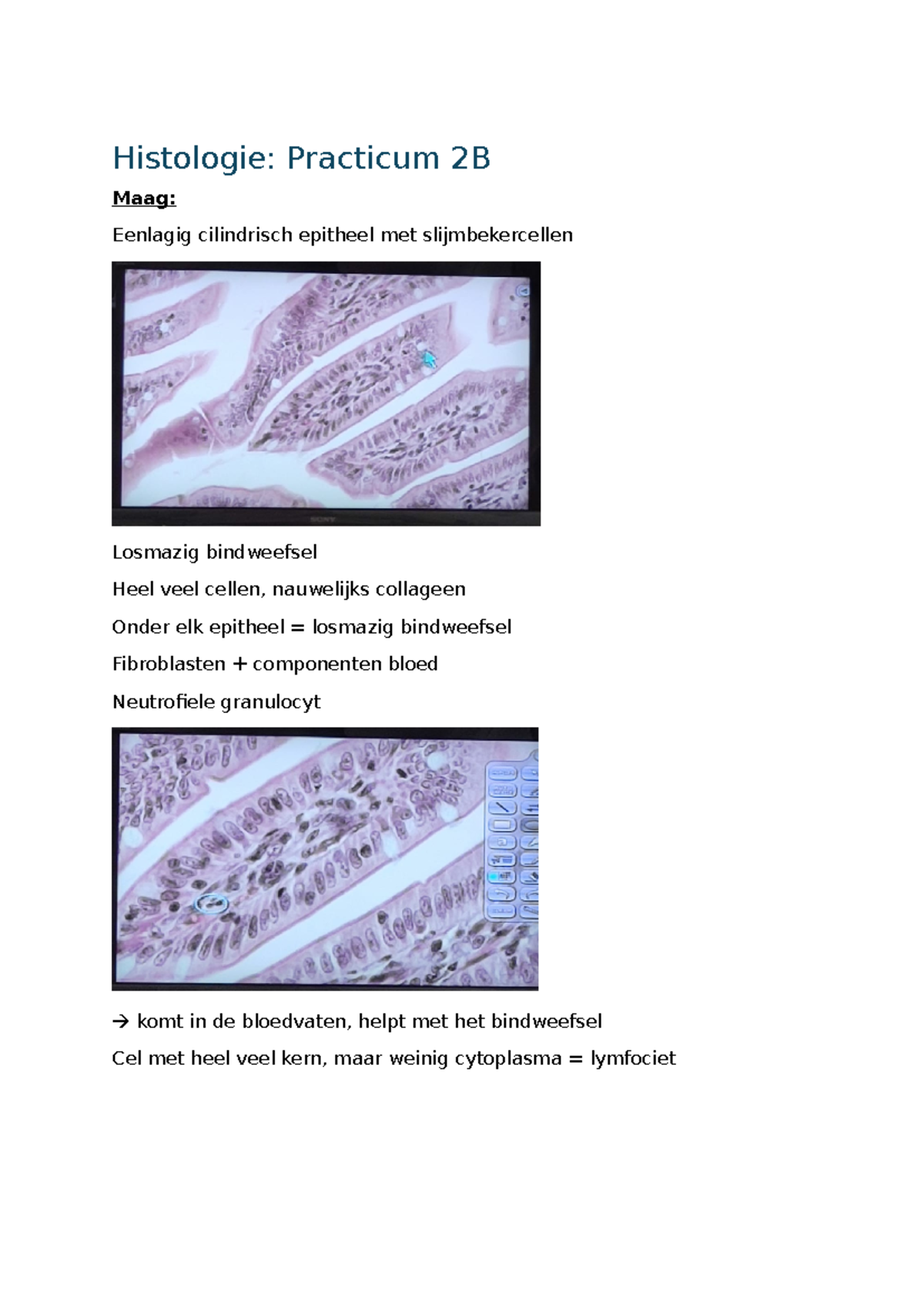 His 2 bot microscoop - Histologie: Practicum 2B Maag: Eenlagig ...