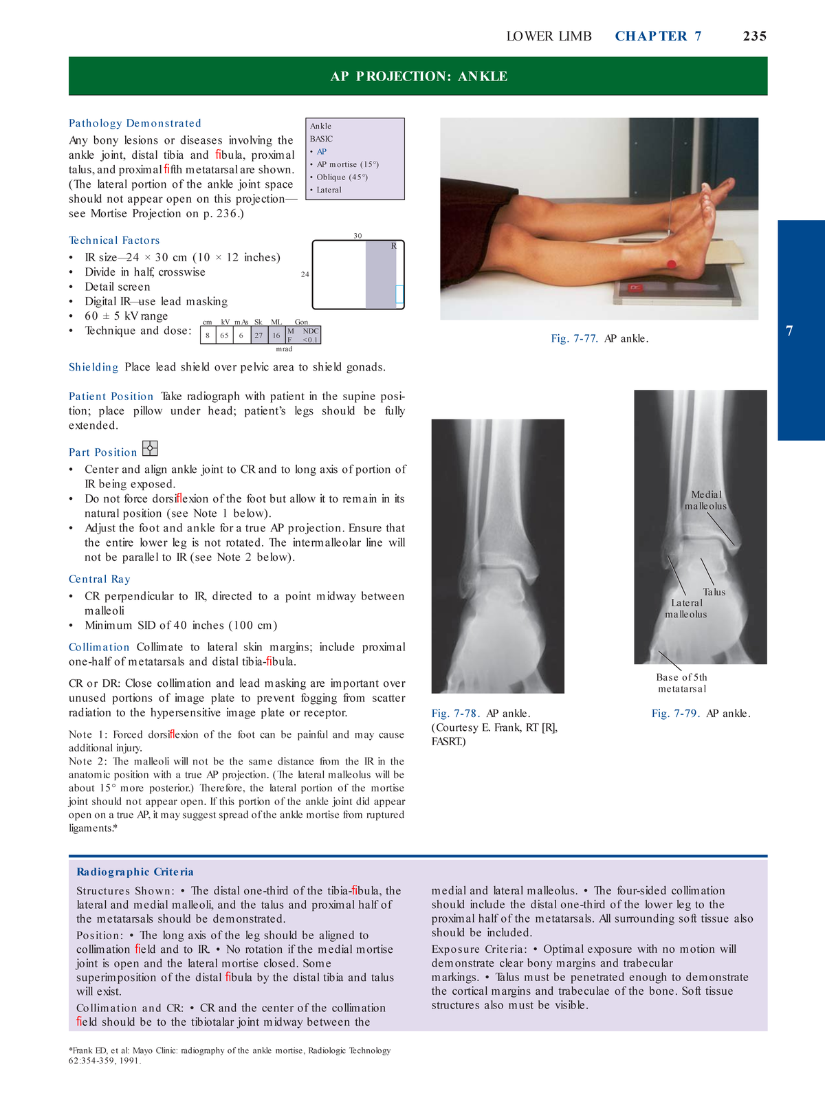 XRAY PROJECTION AP PROJECTION: ANKLE - LO W E R LI M B CHAP TER 7 235 7 ...