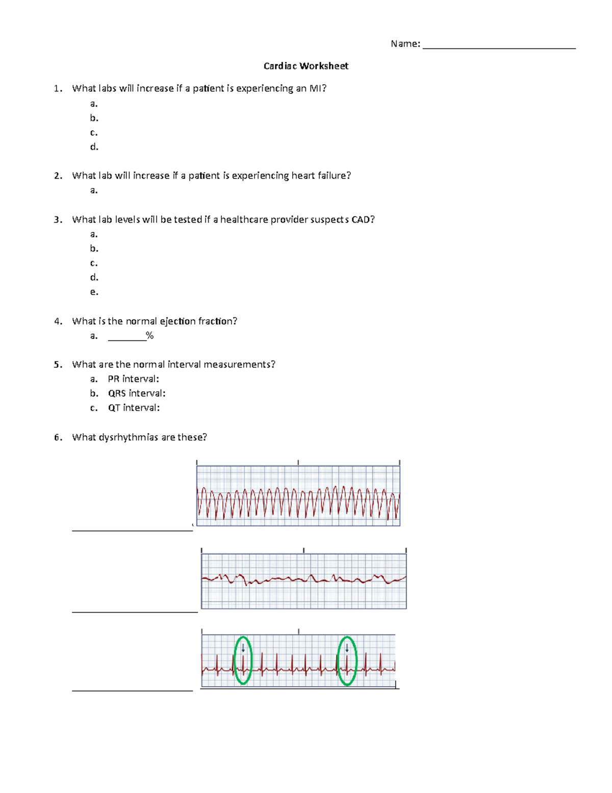 NR324 Cardiac Worksheet - Name: ____________________________ Cardiac ...