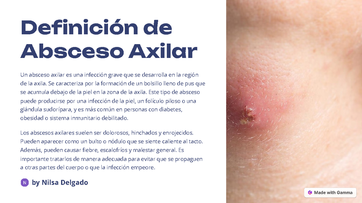 Untitled - oewfij - Definición de Absceso Axilar Un absceso axilar es ...