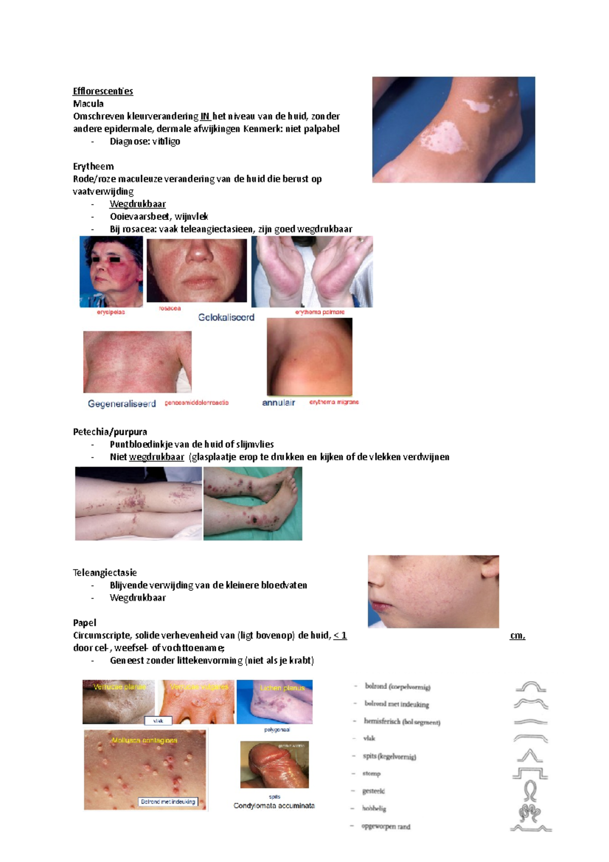 VV Derma efflorescentie - Efflorescenties Macula Omschreven ...