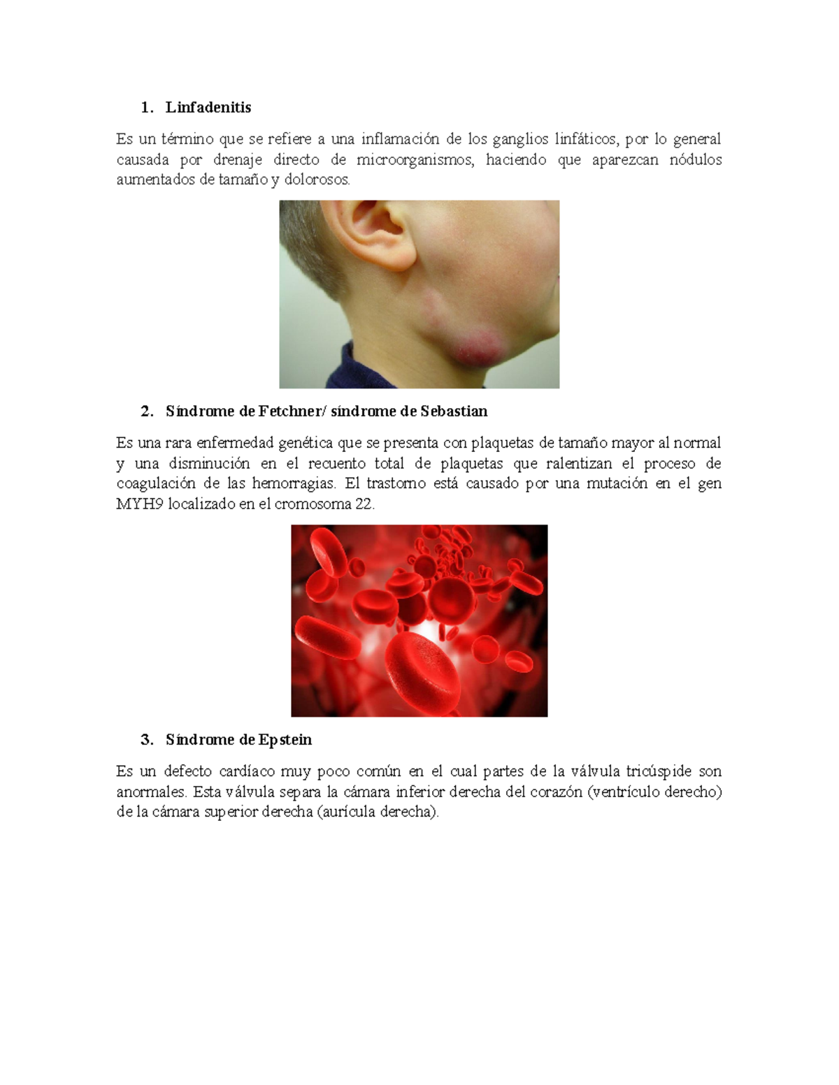 Vocabulario de hematologia - 1. Linfadenitis Es un término que se ...