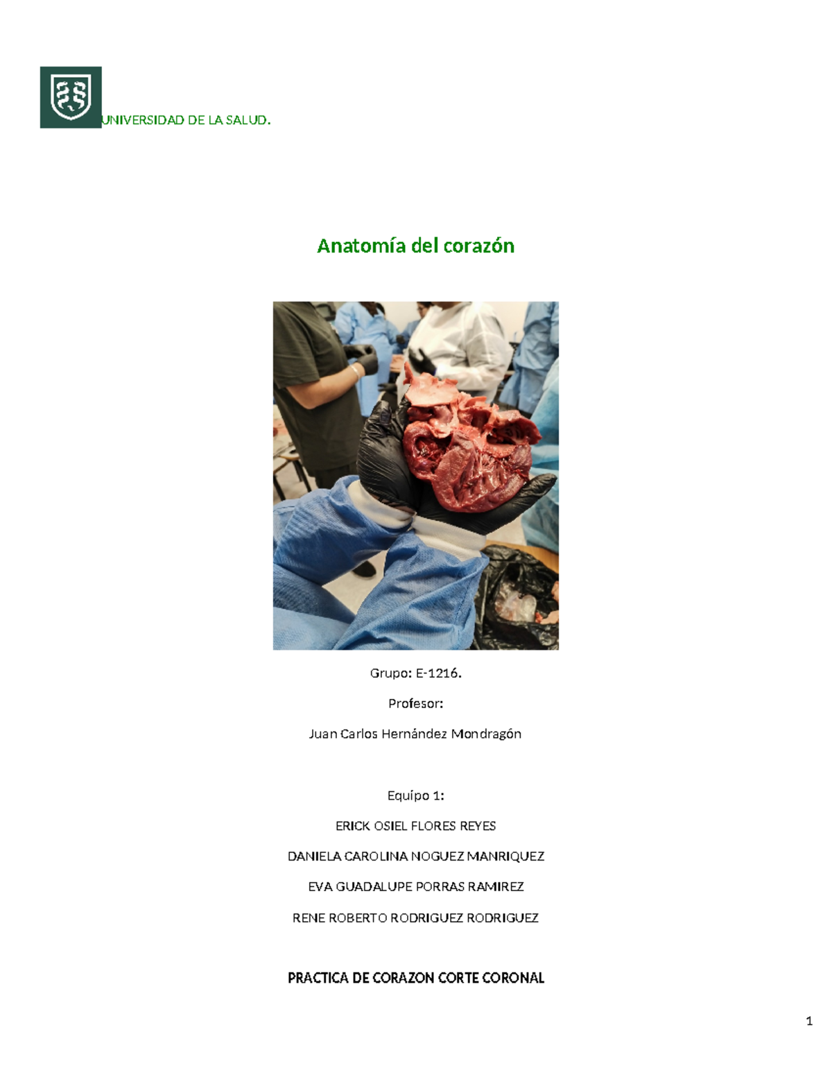 Practica DE Corazon Corte Coronal - Anatomía del corazón Grupo: E-1216 ...