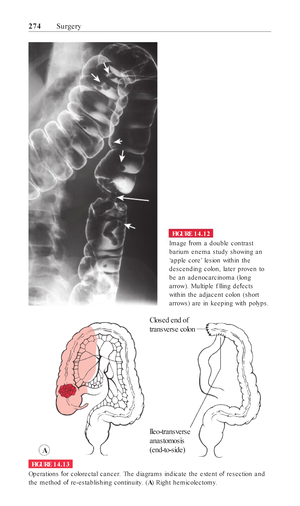 Deja review surgery 1 - Cours - DEJA REVIEW TM Surgery DEJA REVIEW TM ...
