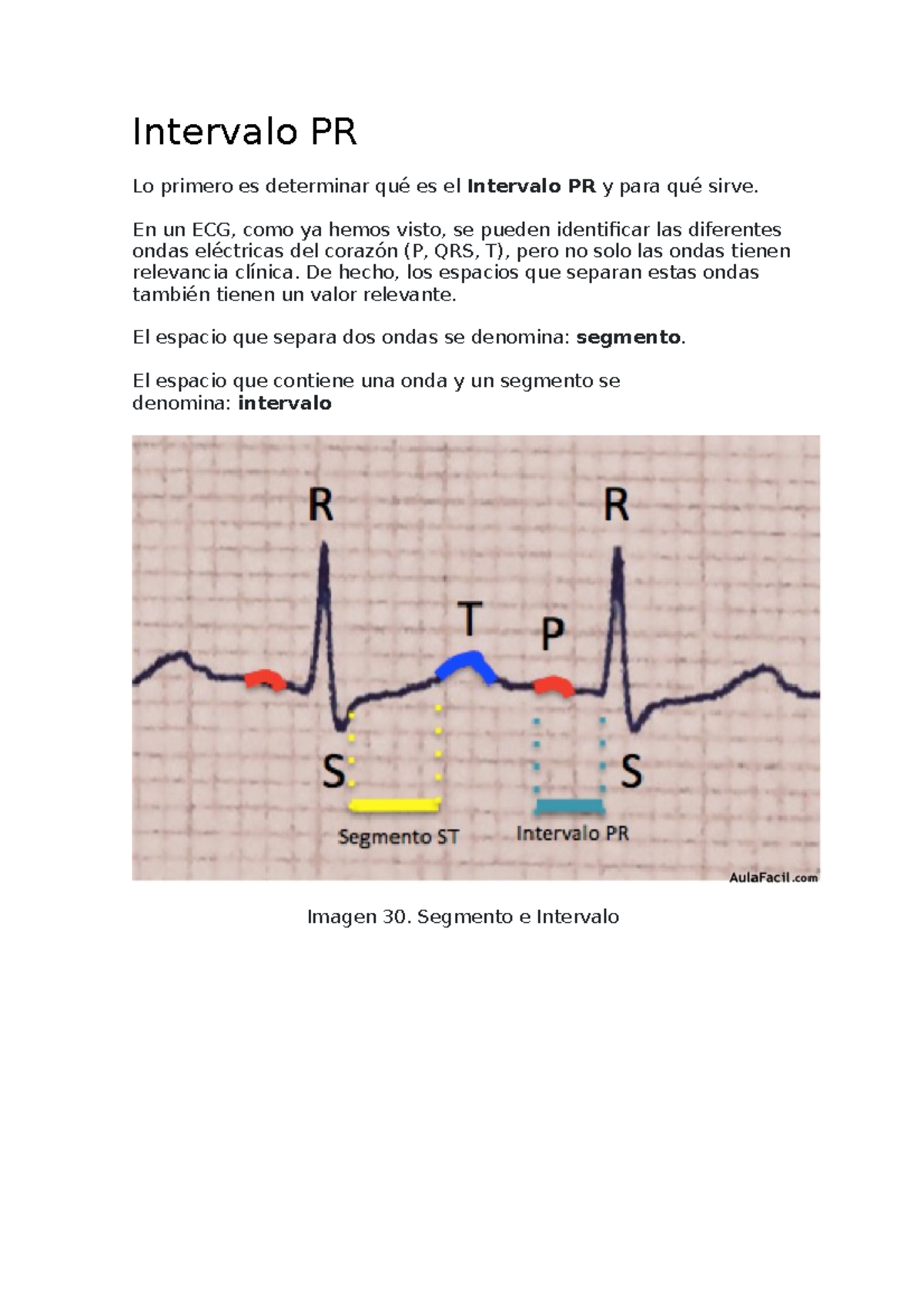 Intervalo PR y segmento ST aprendiendo - Intervalo PR Lo primero es ...