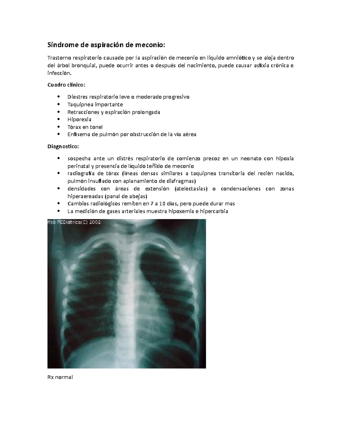 Síndrome de aspiración de meconio - Síndrome de aspiración de meconio ...
