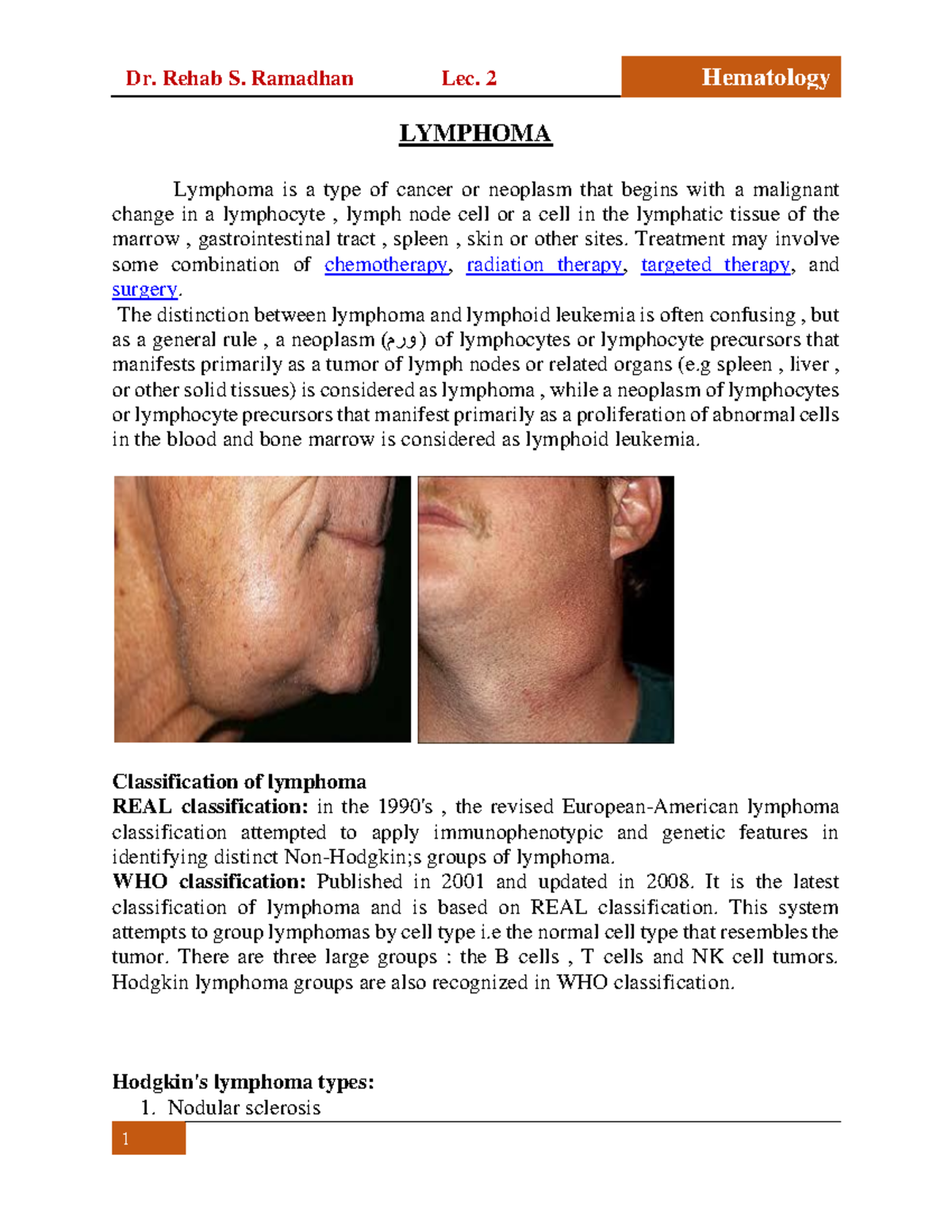 Lymphoma - Hematology - LYMPHOMA Lymphoma is a type of cancer or ...