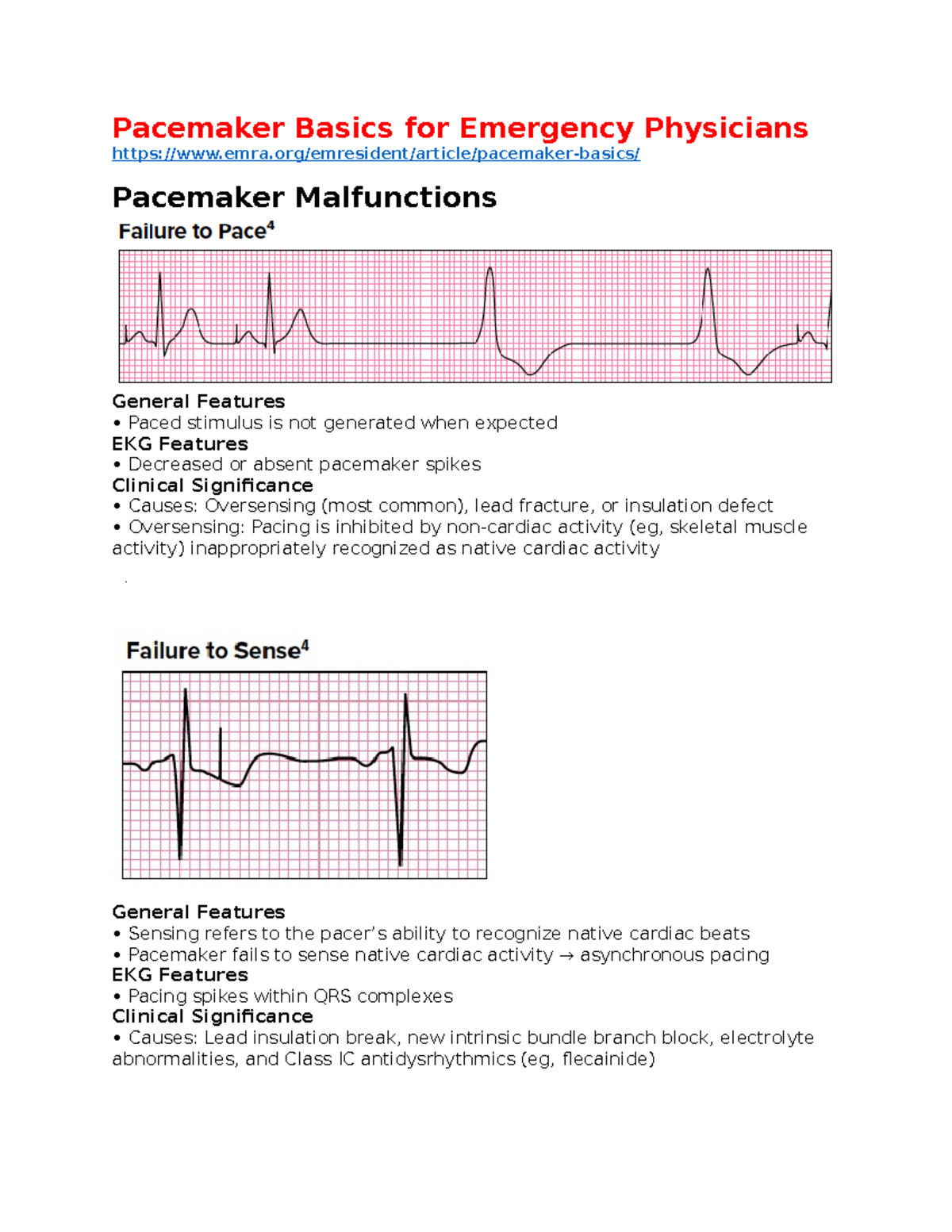 Pacemaker Basics for Emergency Physicians - Pacemaker Basics for ...
