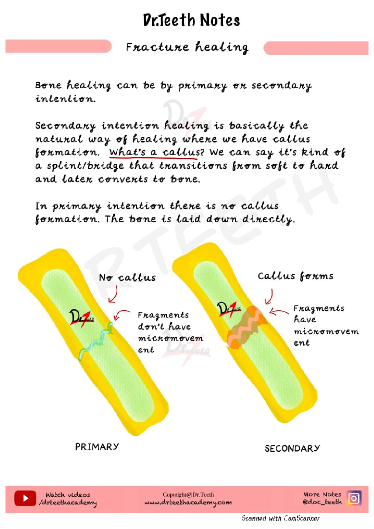 Fracture Healing - Oral surgery notes - Dentistry - Studocu