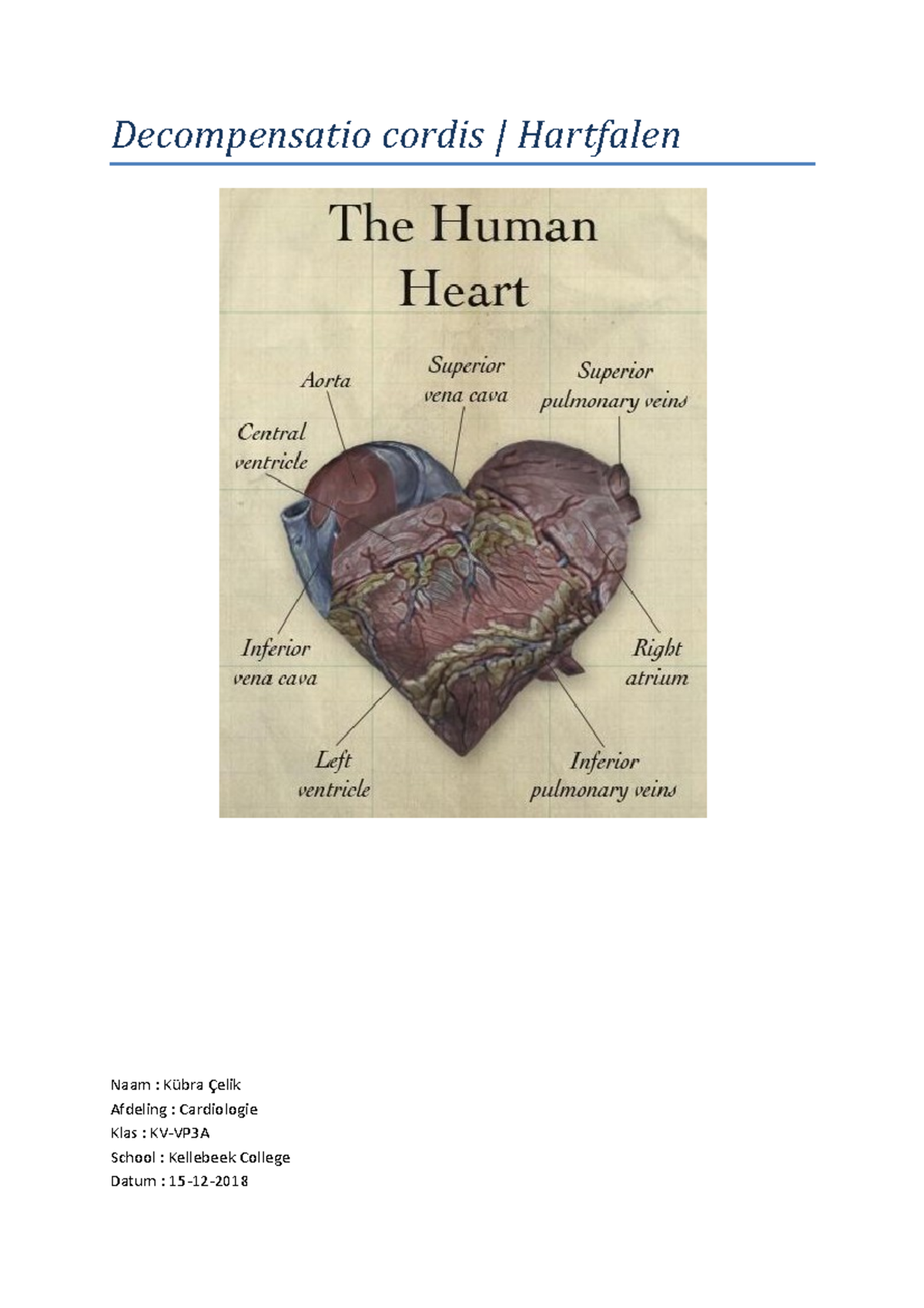 Ziektebeeld Decompensatio cordis - Decompensatio cordis | Hartfalen ...