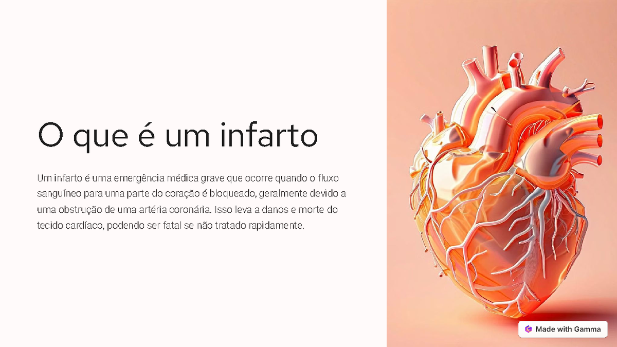 O-que-e-um-infarto - O que é um infarto Um infarto é uma emergência ...