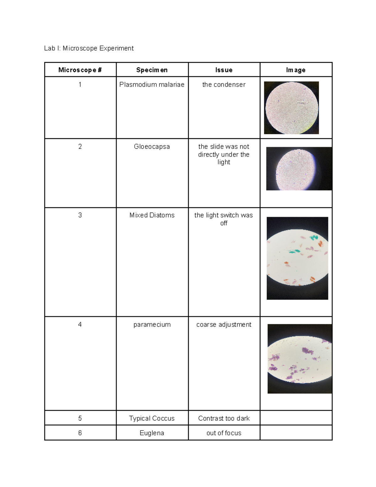 Copy of Microbio - Microscope Assignment - Lab I: Microscope Experiment ...
