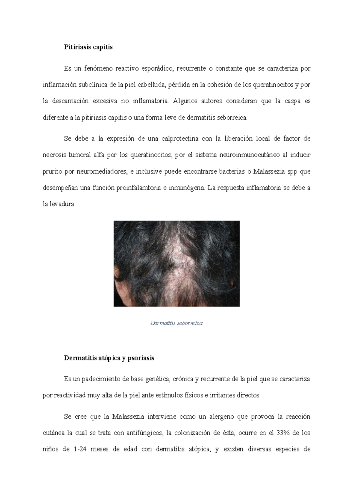 Continuación del cuadro clínico - Pitiriasis capitis Es un fenómeno ...