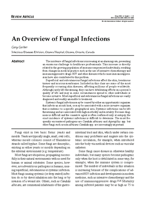 Flegmasia ALBA Dolens - 1. FLEGMASIA ALBA DOLENS es una manifestación ...