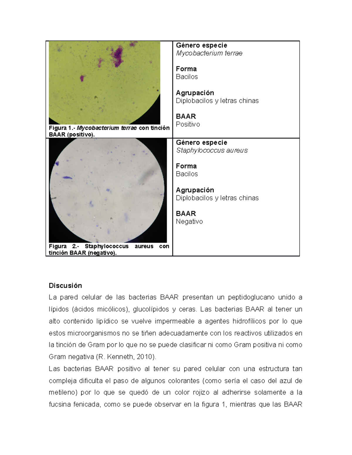 Reporte bacter practica 5 - Figura 1.- Mycobacterium terrae con tinción ...