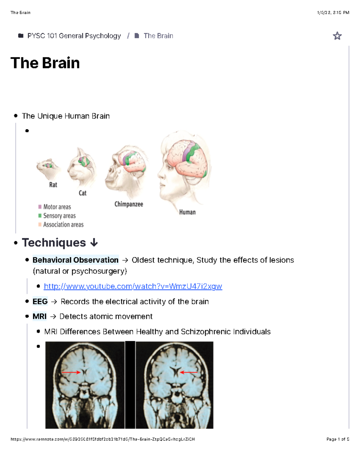 PSYC 101 Notes - The Brain - PYSC 101 General Psychology The Brain The ...