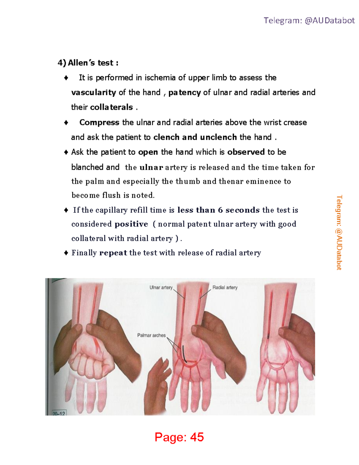 General surgery lecure notes 13 - Allen’s test : It is performed in ...