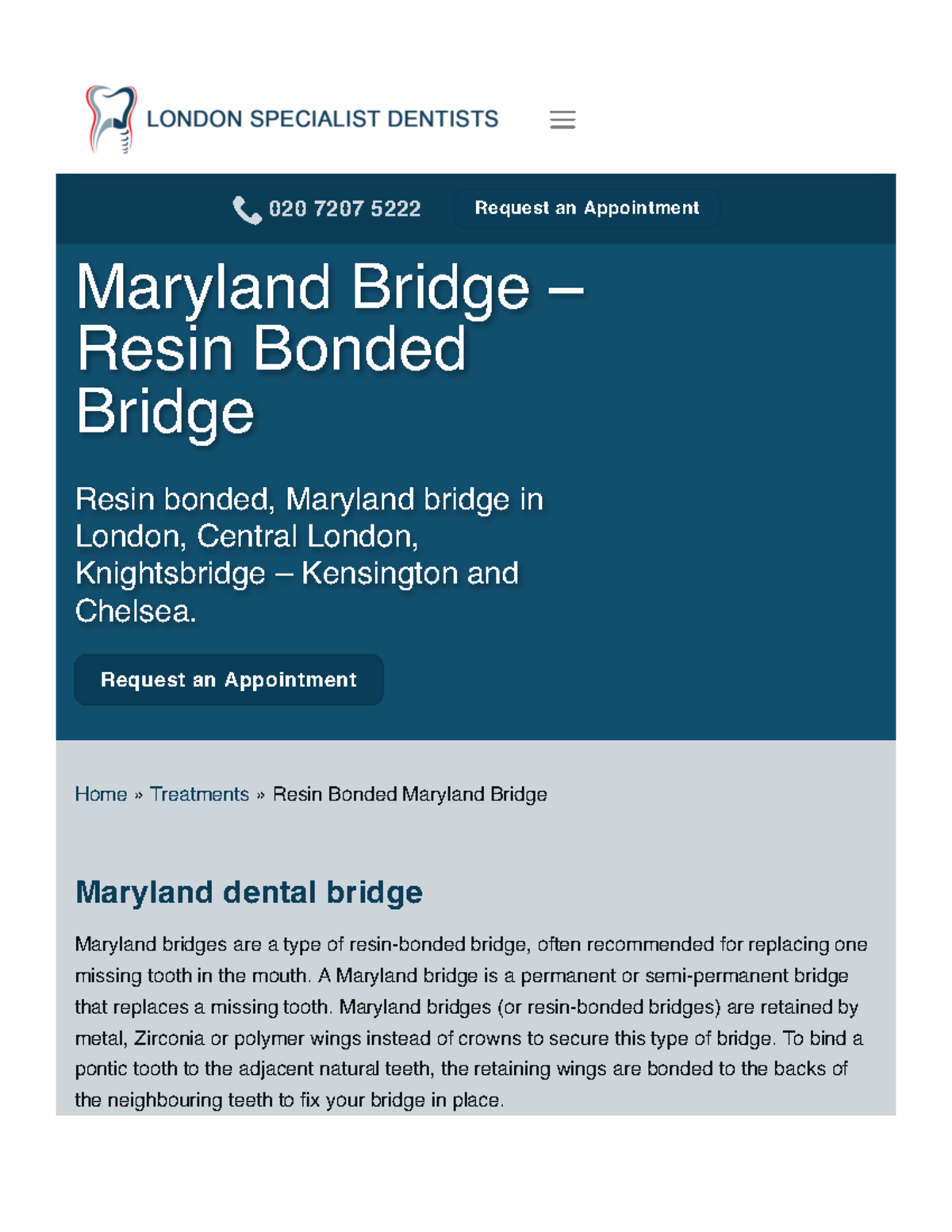 Resin Bonded Maryland Bridge - London Specialist Dentists - Home ...