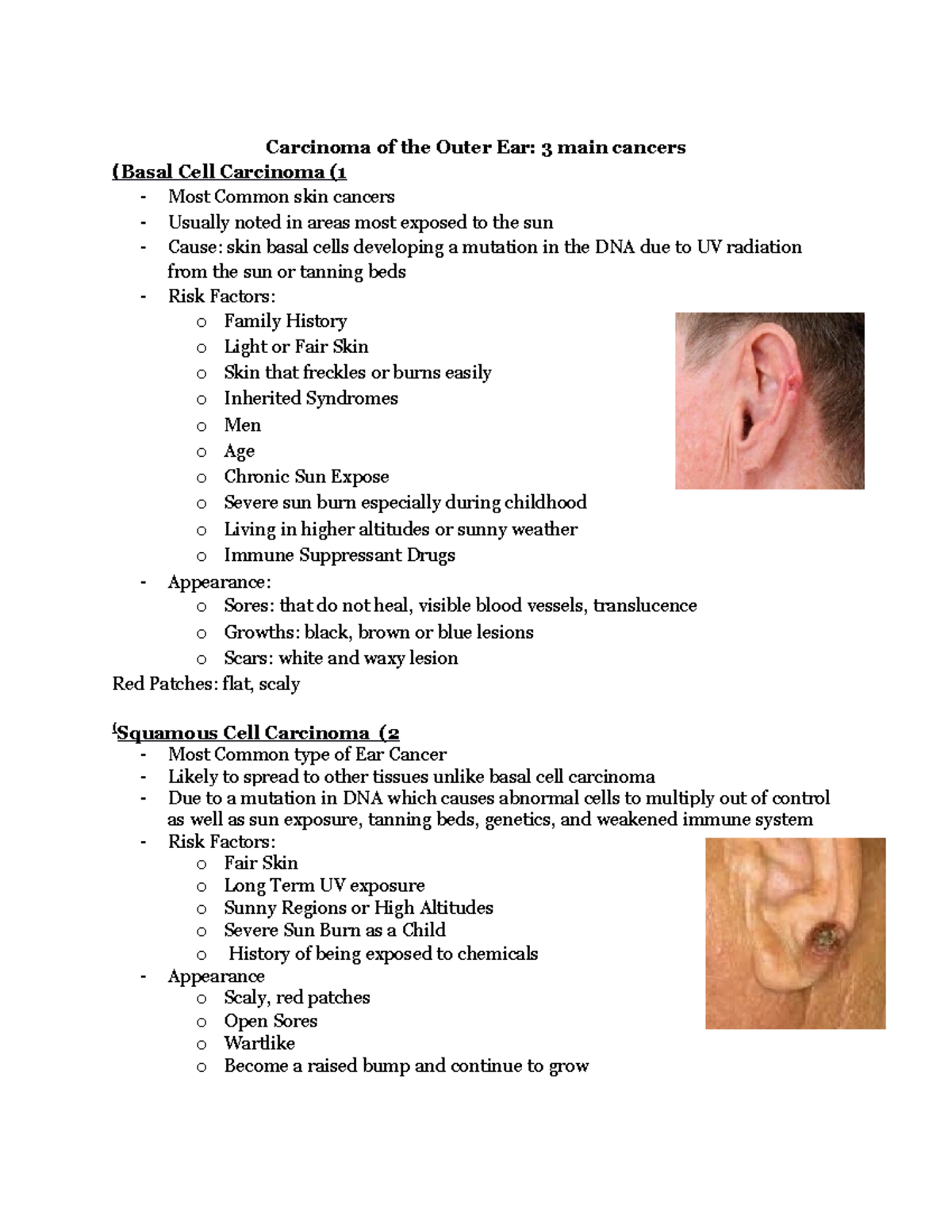 Final Exam Study Guide 2 - Carcinoma of the Outer Ear: 3 main cancers ...