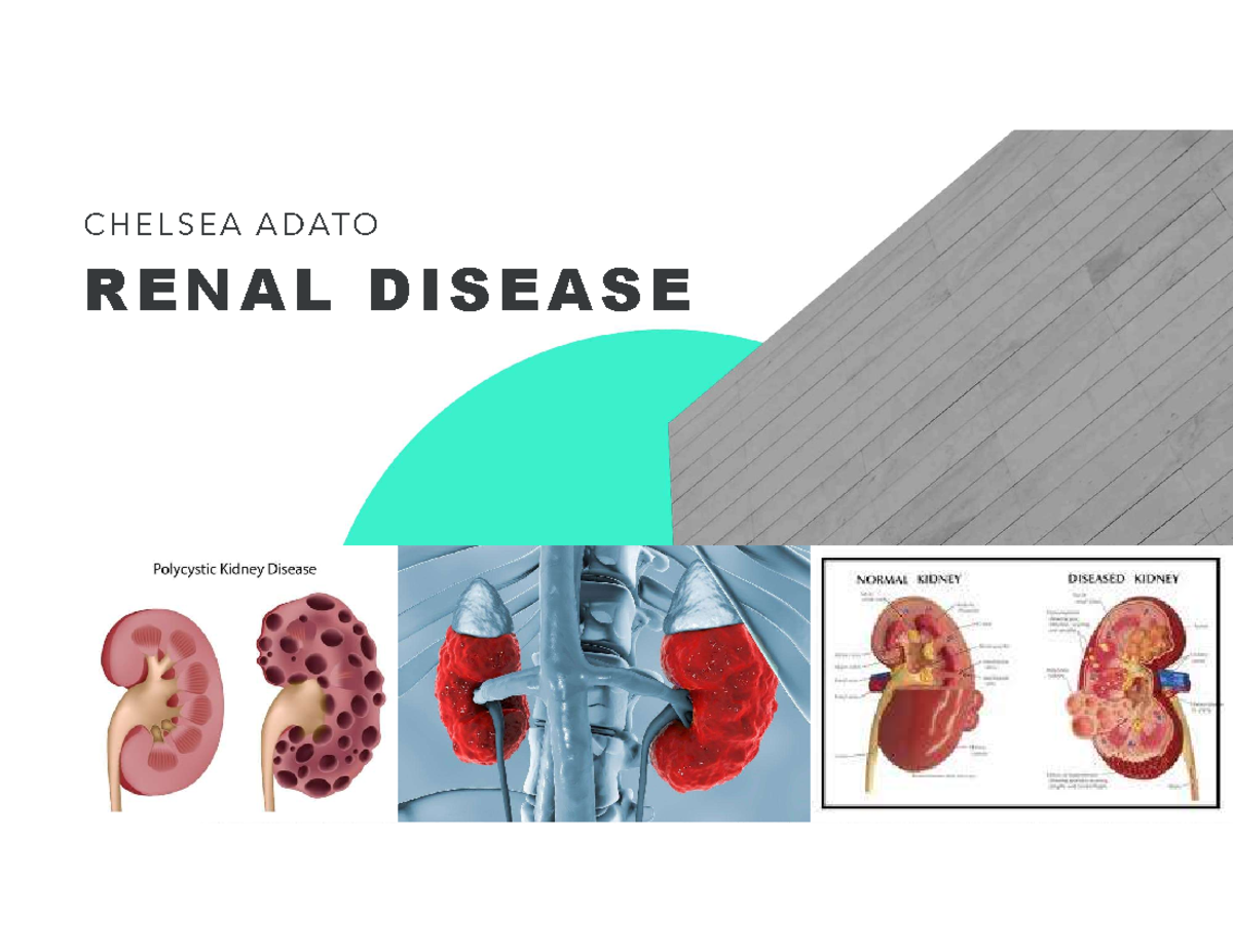 Renal Disease - asd - C H E L S E A A D ATO R E N A L D I S E A S E I N ...