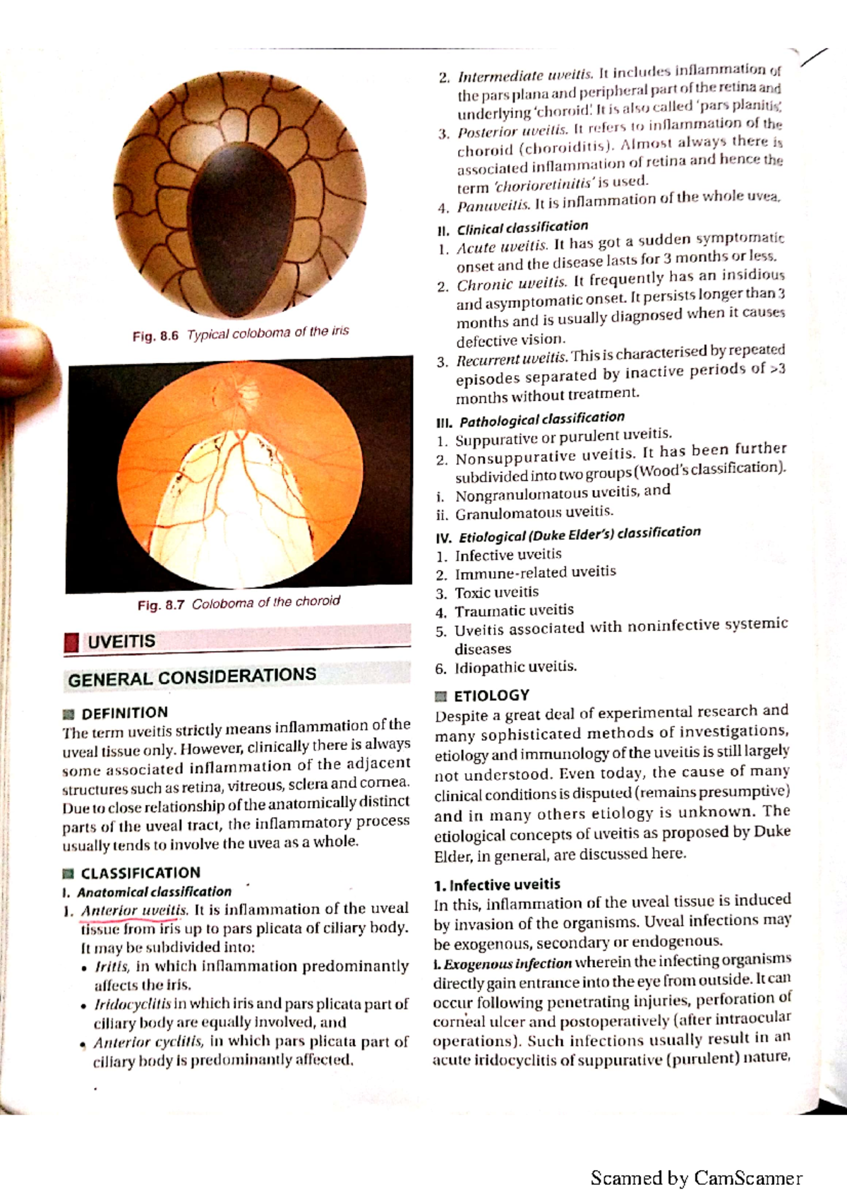 Uveitis and it's classification - Bsc Optometry - Studocu