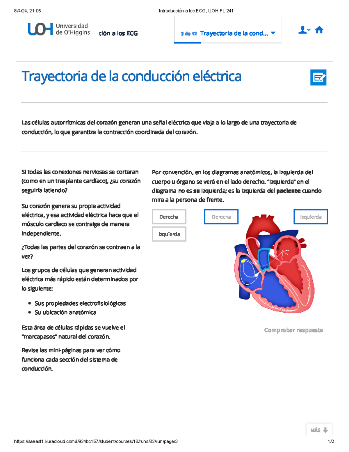 Electrocardiograma 2 - 8/4/24, 21:05 Introducción a los ECG, UOH FL 241 ...