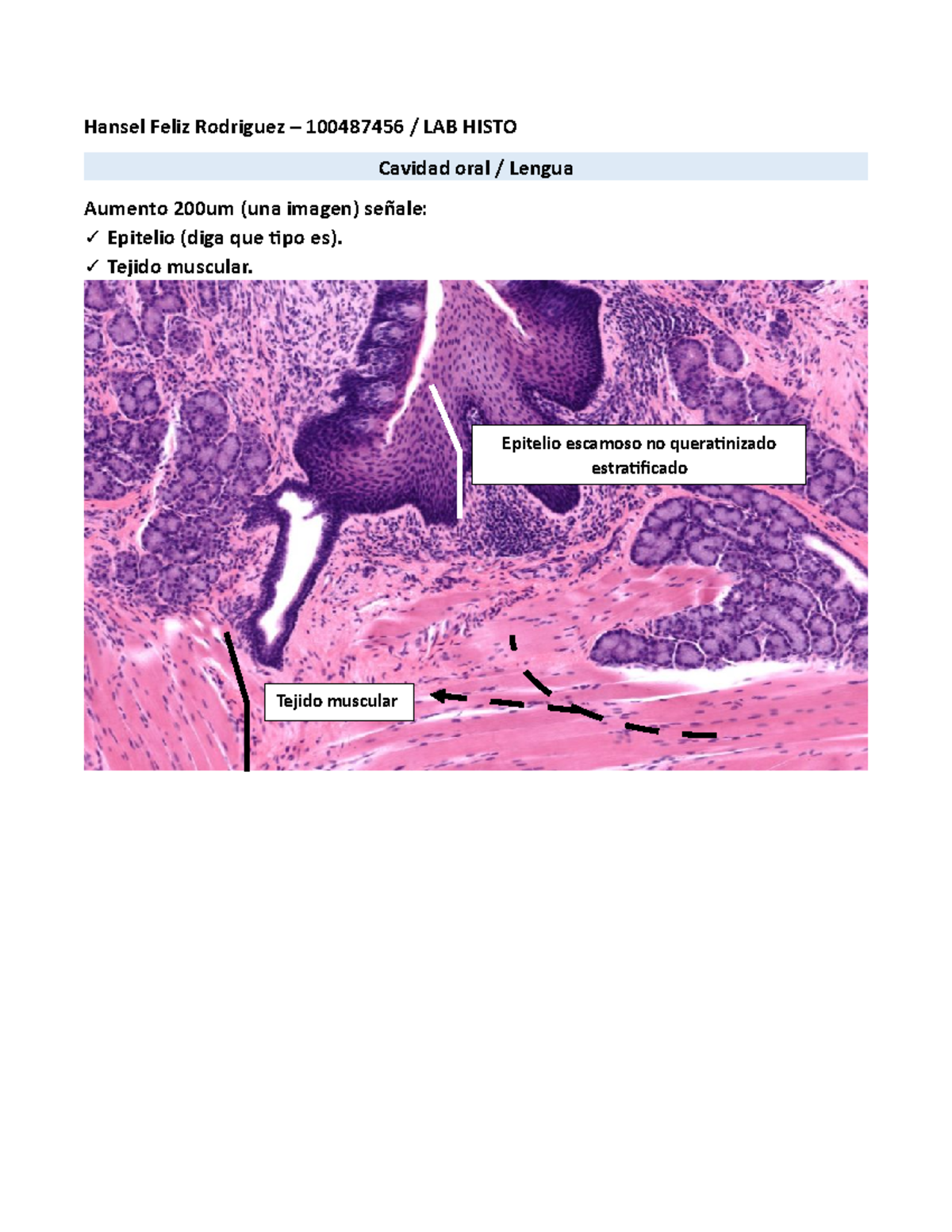 Plaquitas- Histo- Practica Final - Hansel Feliz Rodriguez – 100487456 / LAB HISTO Cavidad oral ...
