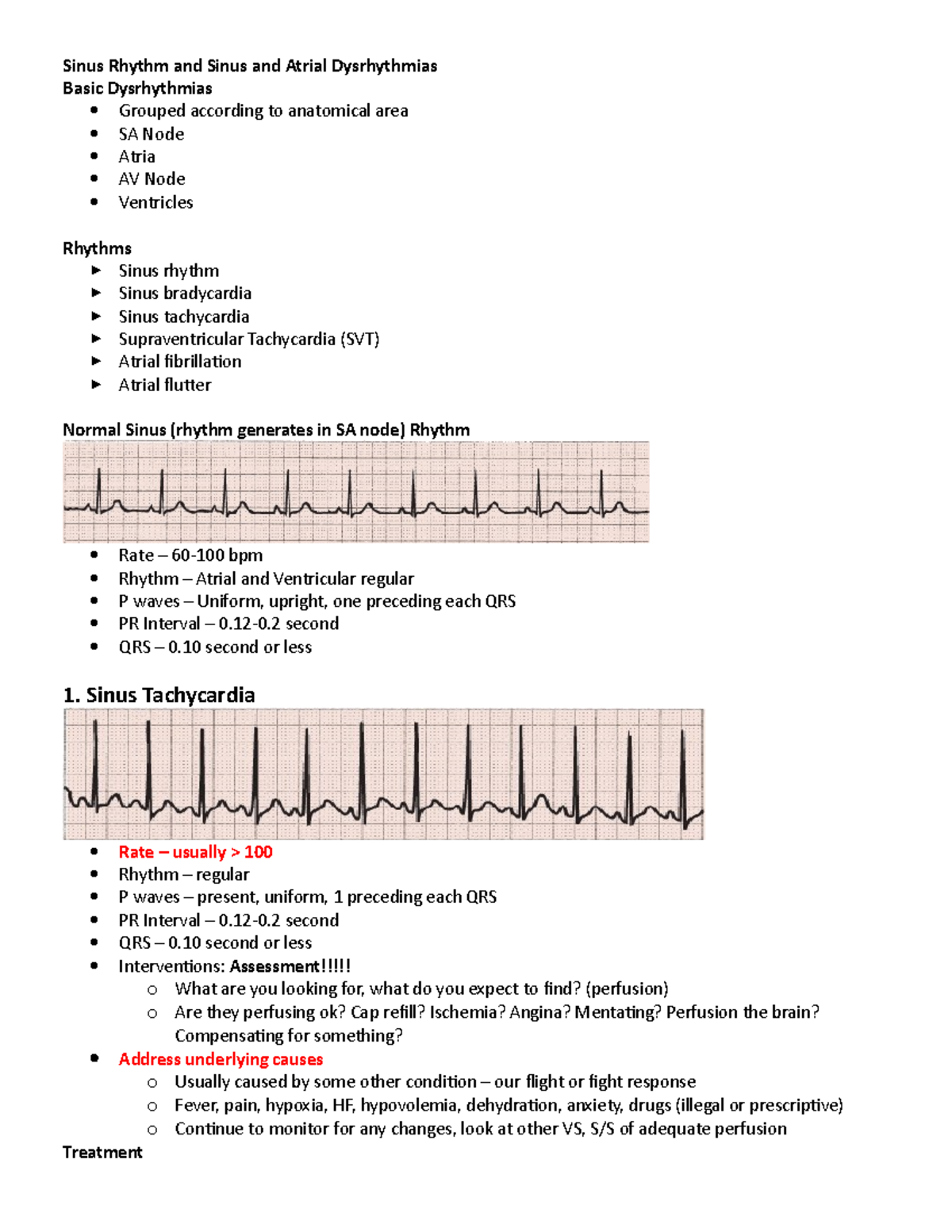 2020-Nurs420 Sinus Rhythm and Sinus and Atrial Dysrhythmias lecture ...