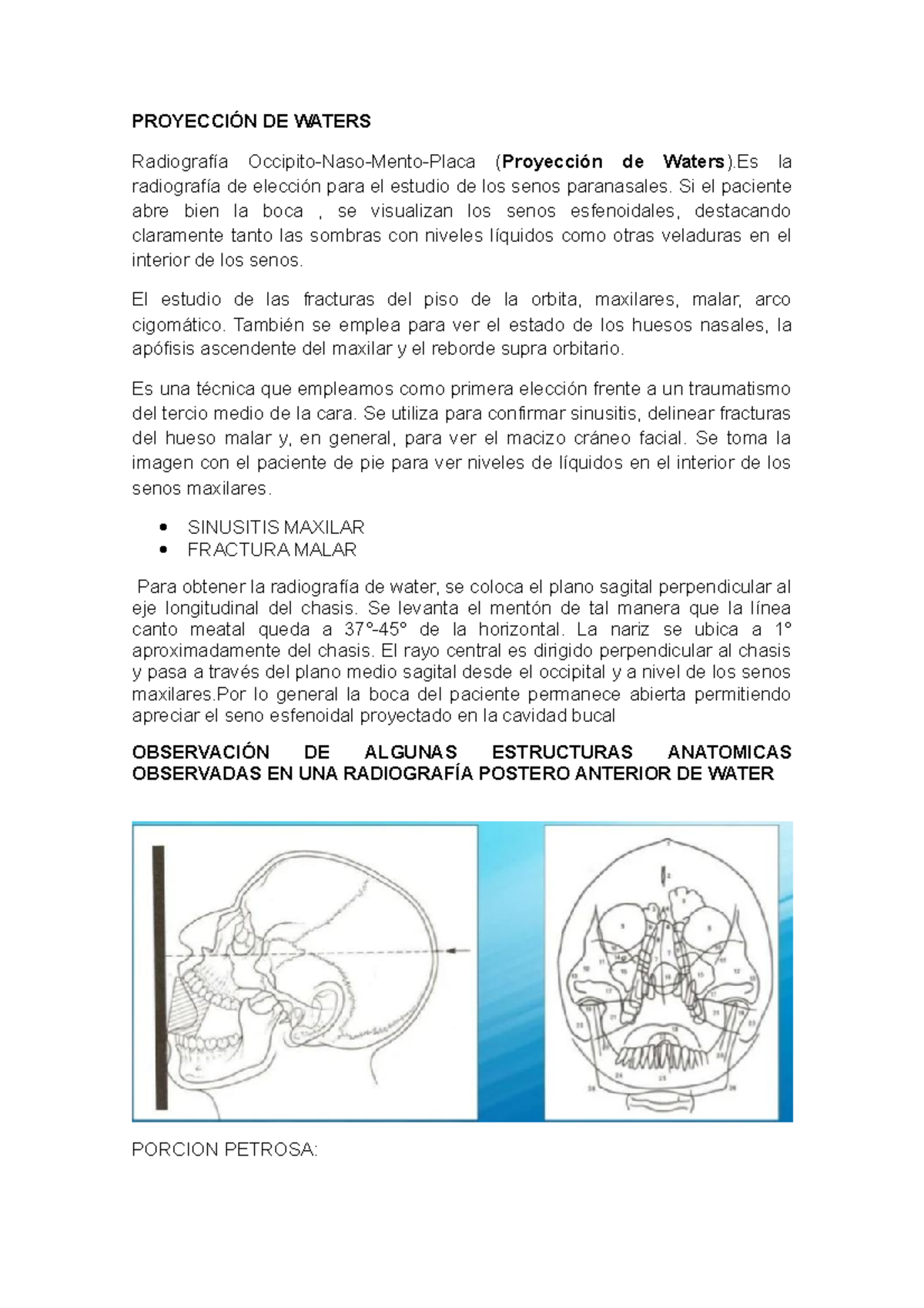 Nicole proyeccion de waters - PROYECCIÓN DE WATERS Radiografía Occipito ...