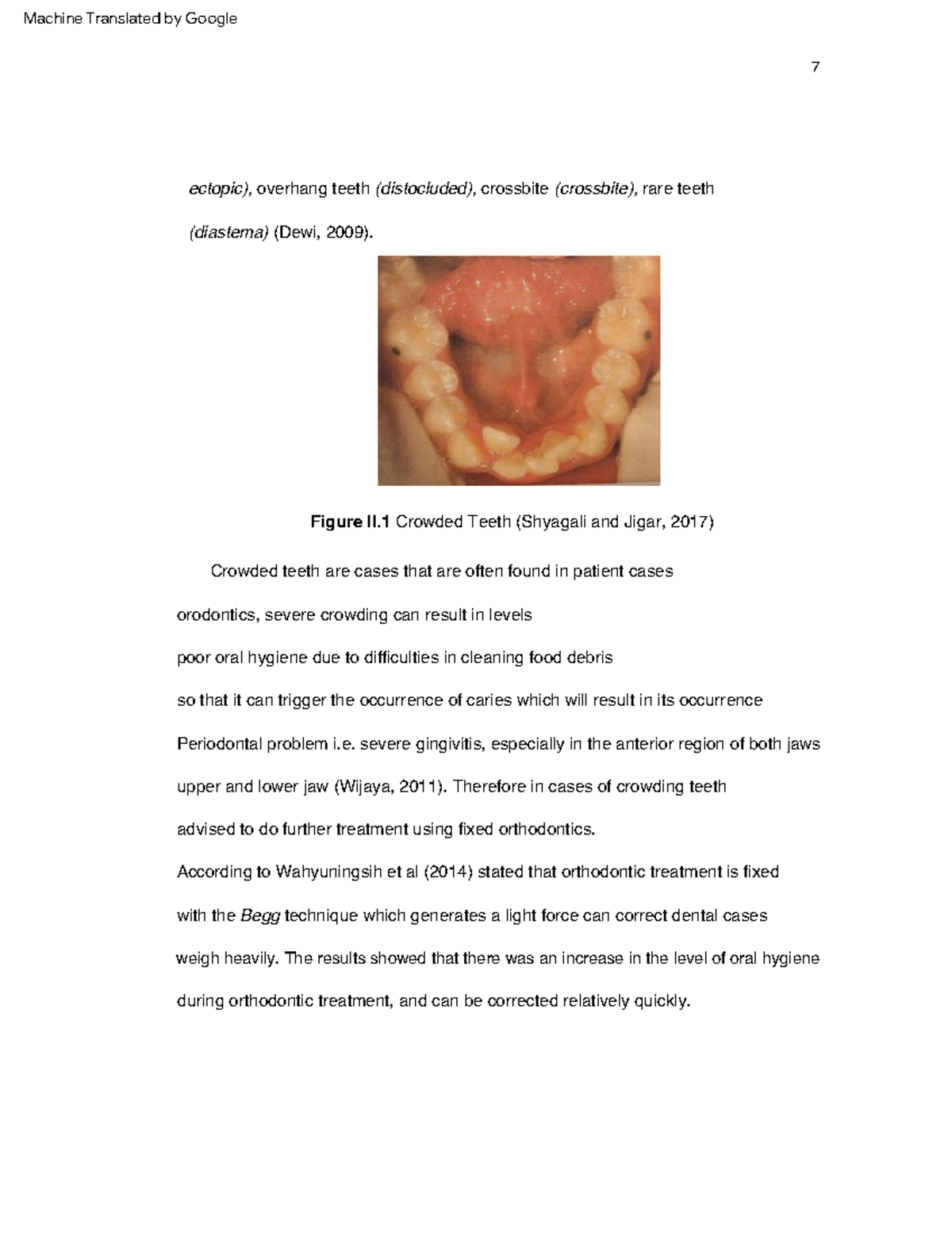 Human psyc-23 - Notes - 7 orodontics, severe crowding can result in ...