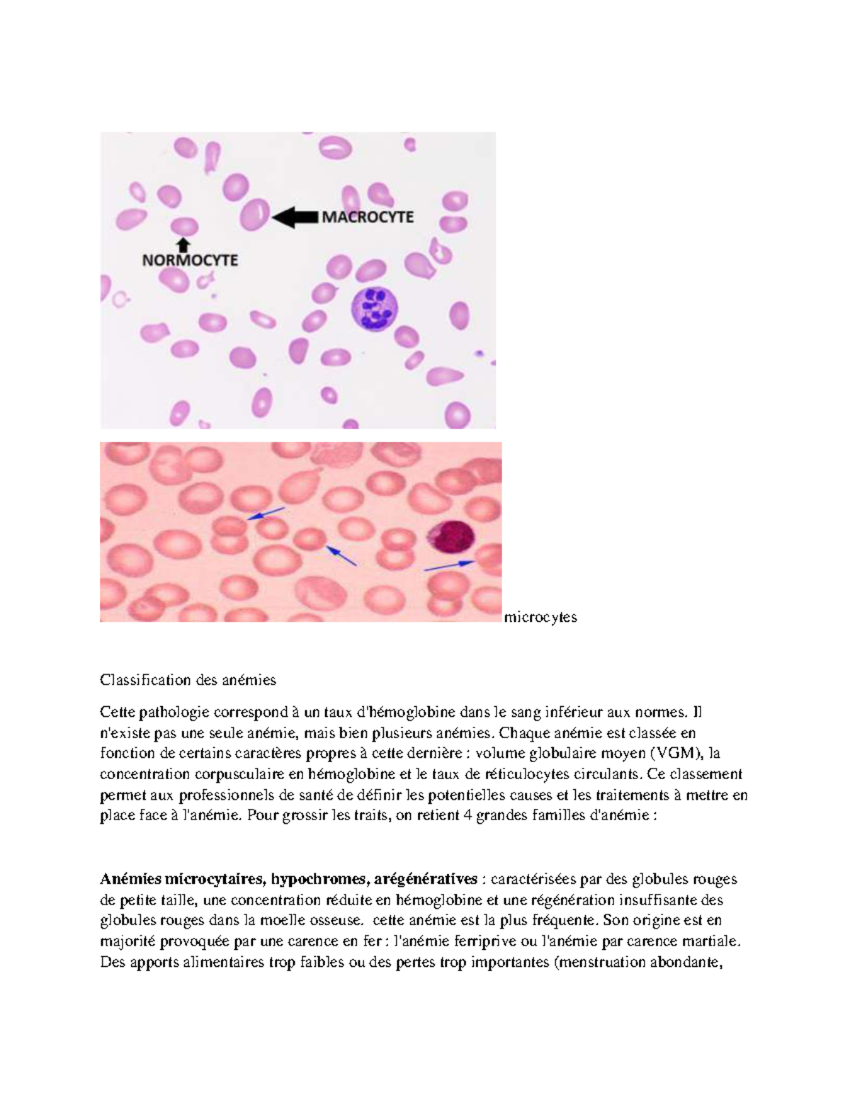 Les types d'anémies - microcytes Classification des anémies Cette ...