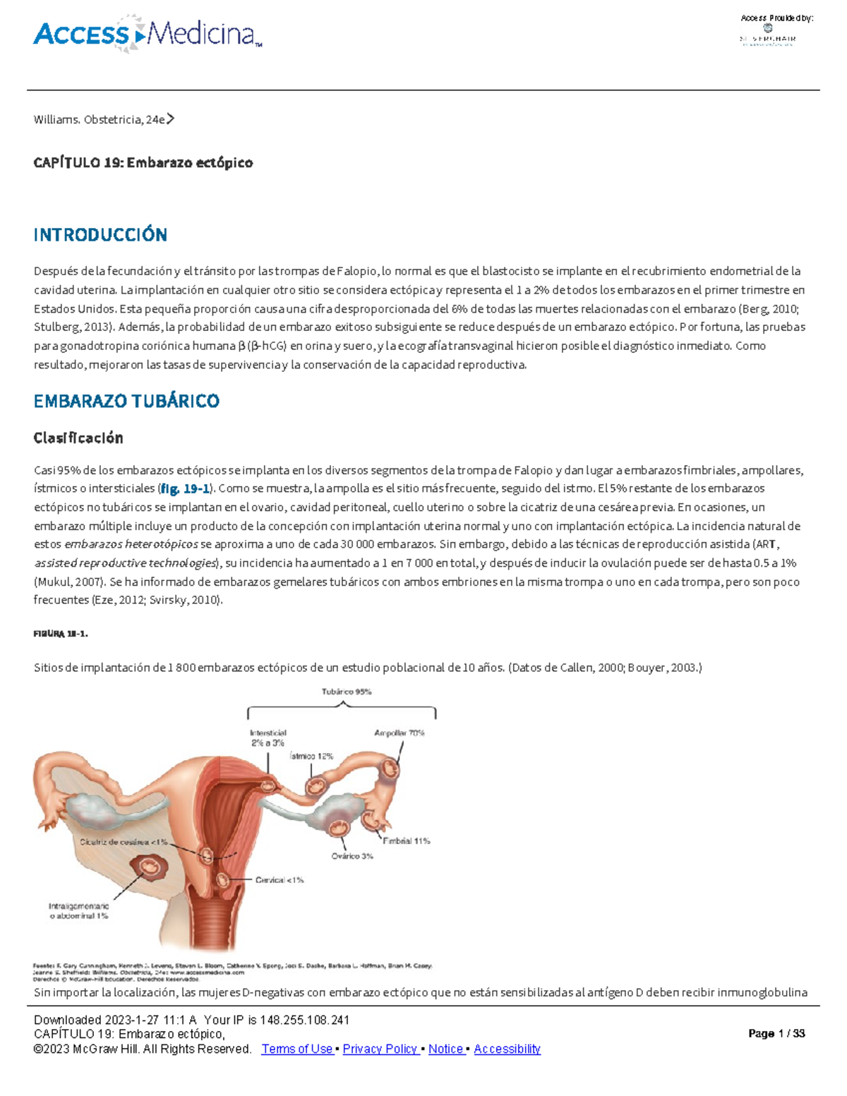 Capítulo 19 Embarazo ectópico - Williams. Obstetricia, 24e CAPÍTULO 19 ...