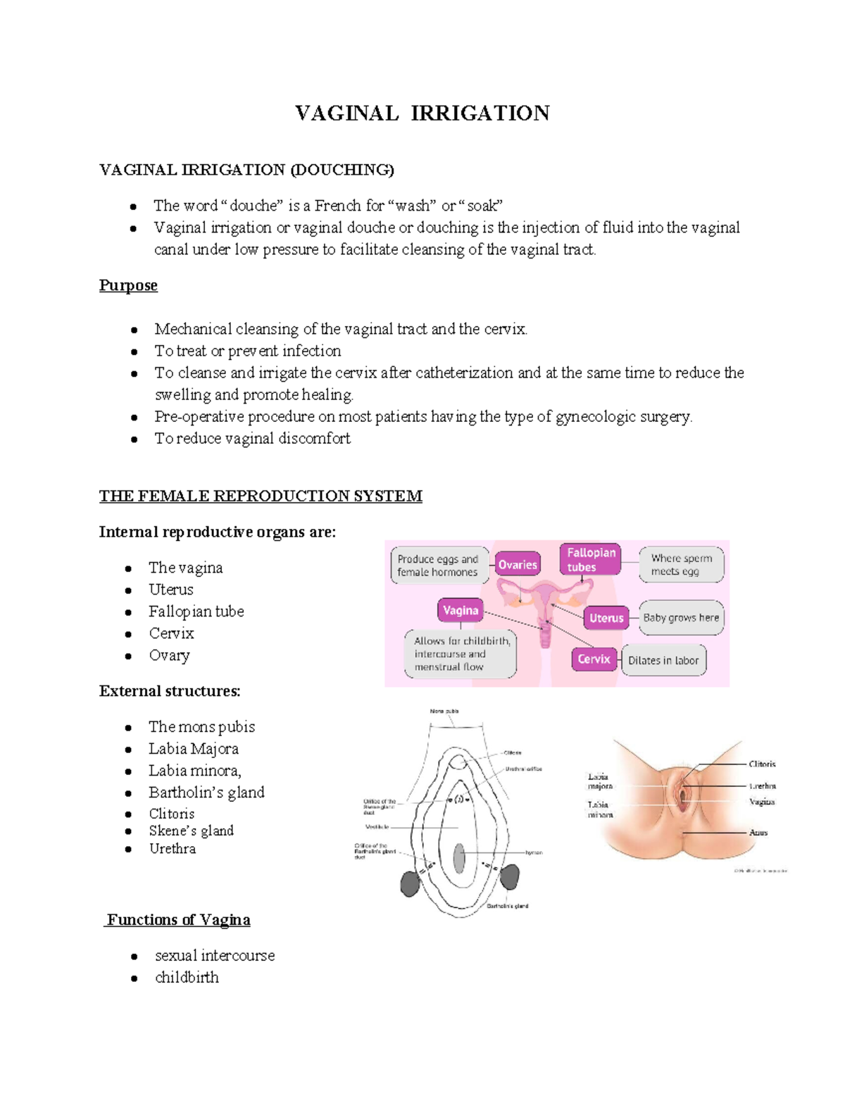 Vaginal- Irrigation- Handouts - VAGINAL IRRIGATION VAGINAL IRRIGATION ...