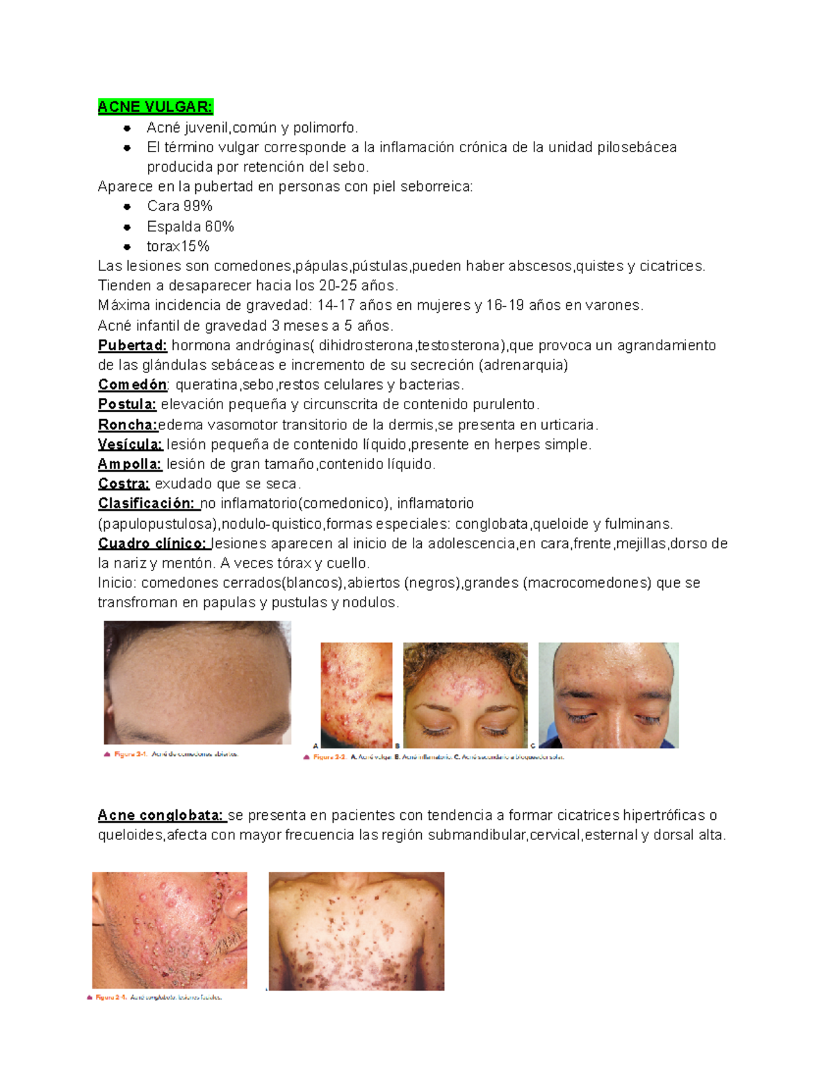 Guia de derma - es una guia - ACNE VULGAR: Acné juvenil,común y ...