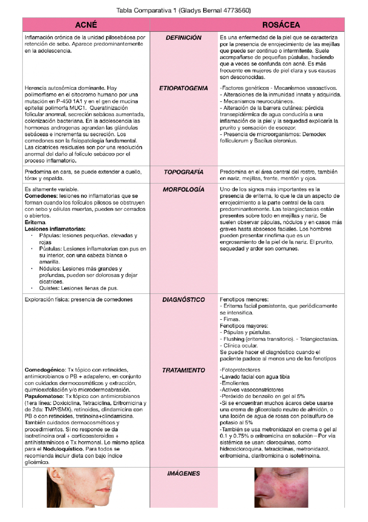 ACNÉ VS Rosácea - Infectología y Dermatología - Studocu
