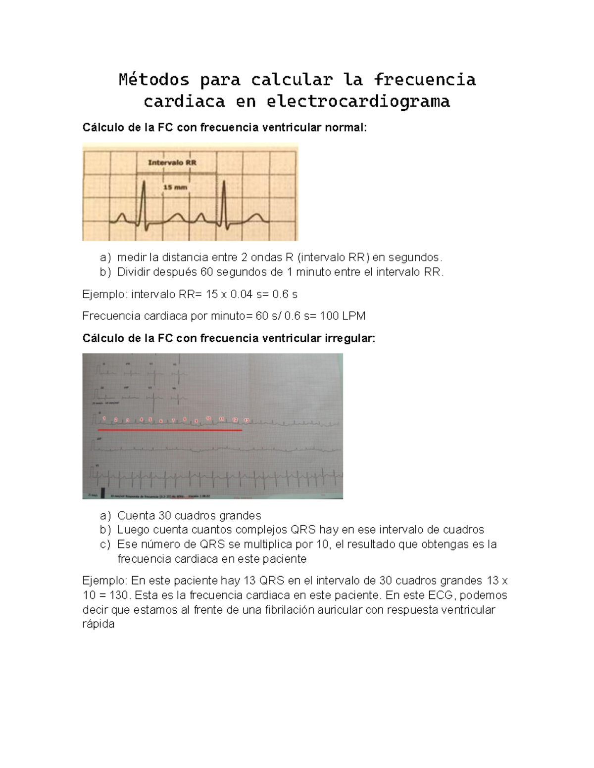 Metodos para calcular ECG - Métodos para calcular la frecuencia ...