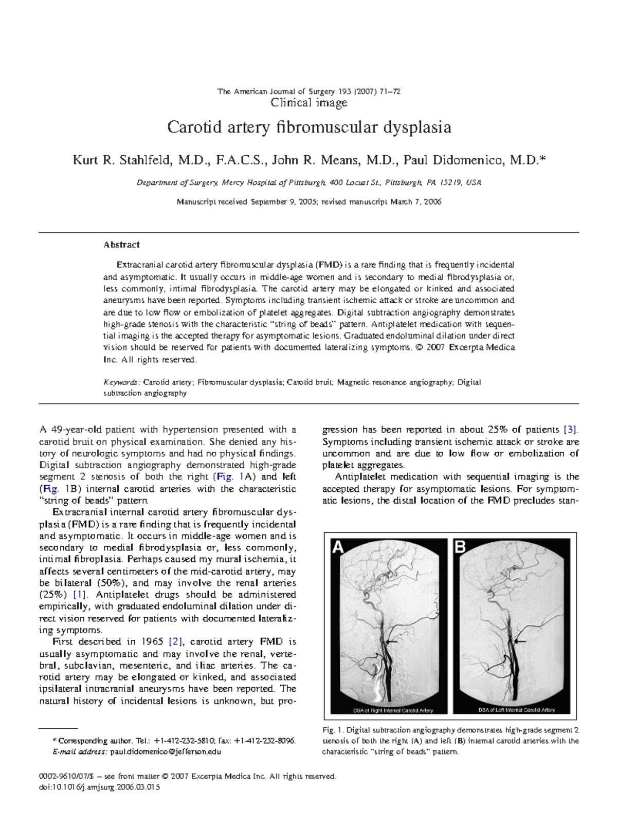 Carotid artery fibromuscular dysplasia Kurt R - Stahlfeld, M., F.A.C ...