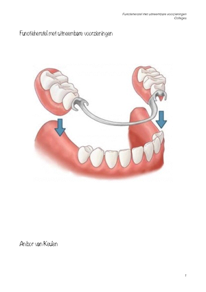 Partiele plaat prothese eerste deel - Plaatprothese: kunststof ...