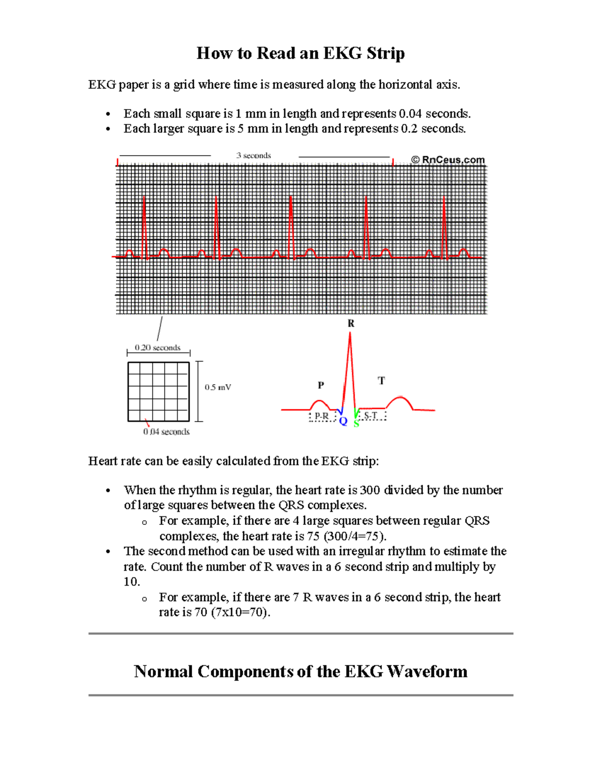 Basic EKG Dysrhythmia Identification - How to Read an EKG Strip EKG ...
