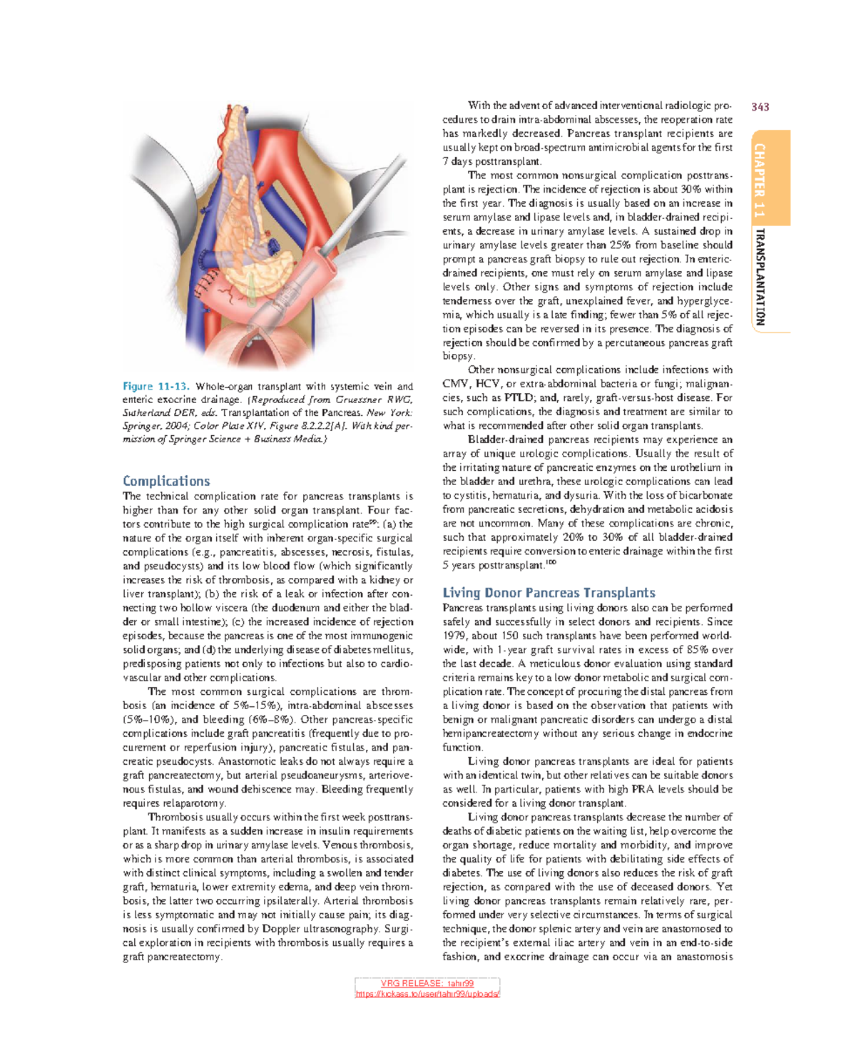 Schwartz's Principles of Surgery-36 - 343 TRANSPLANTATION CHAPTER 11 ...