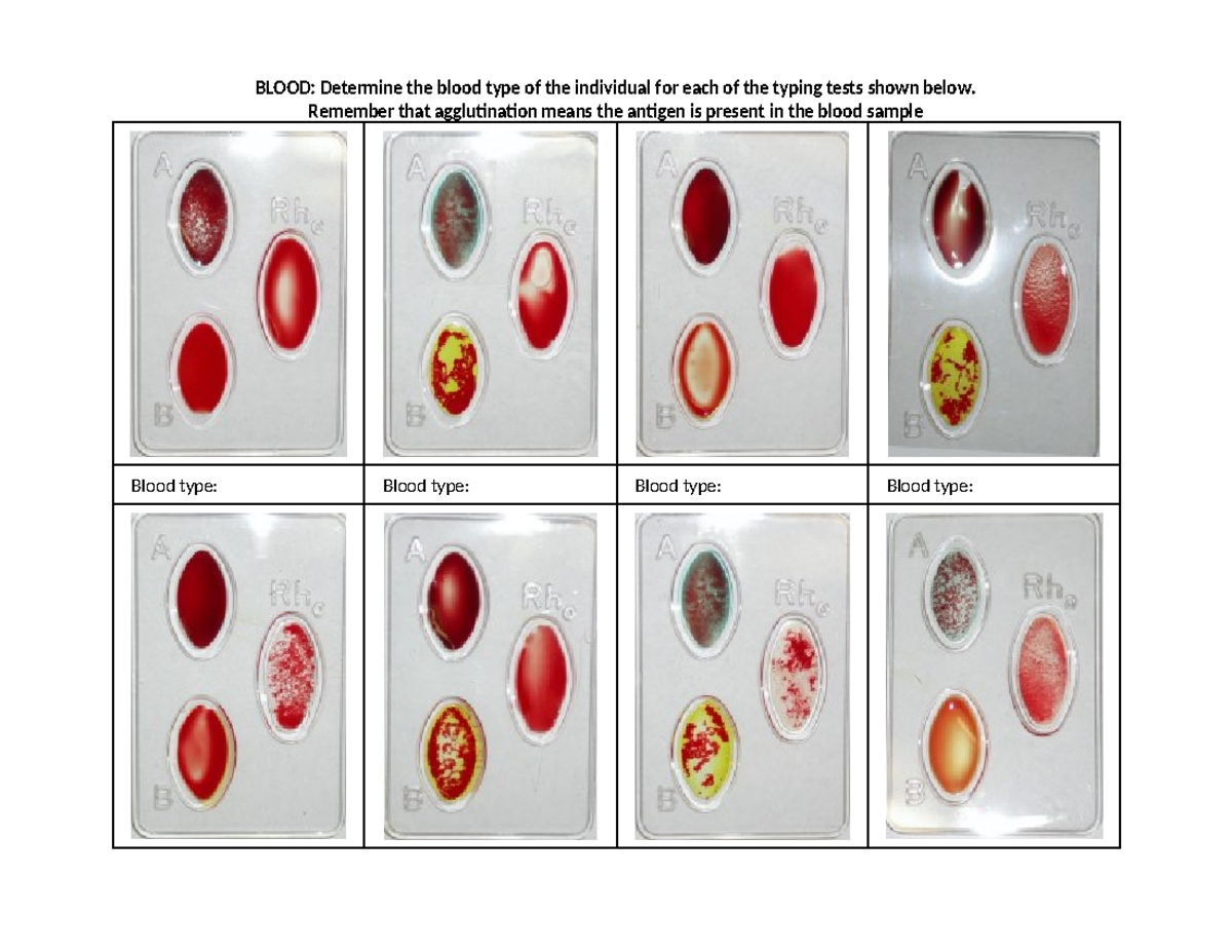 Blood-Heart Lab report-Word - BLOOD: Determine the blood type of the ...