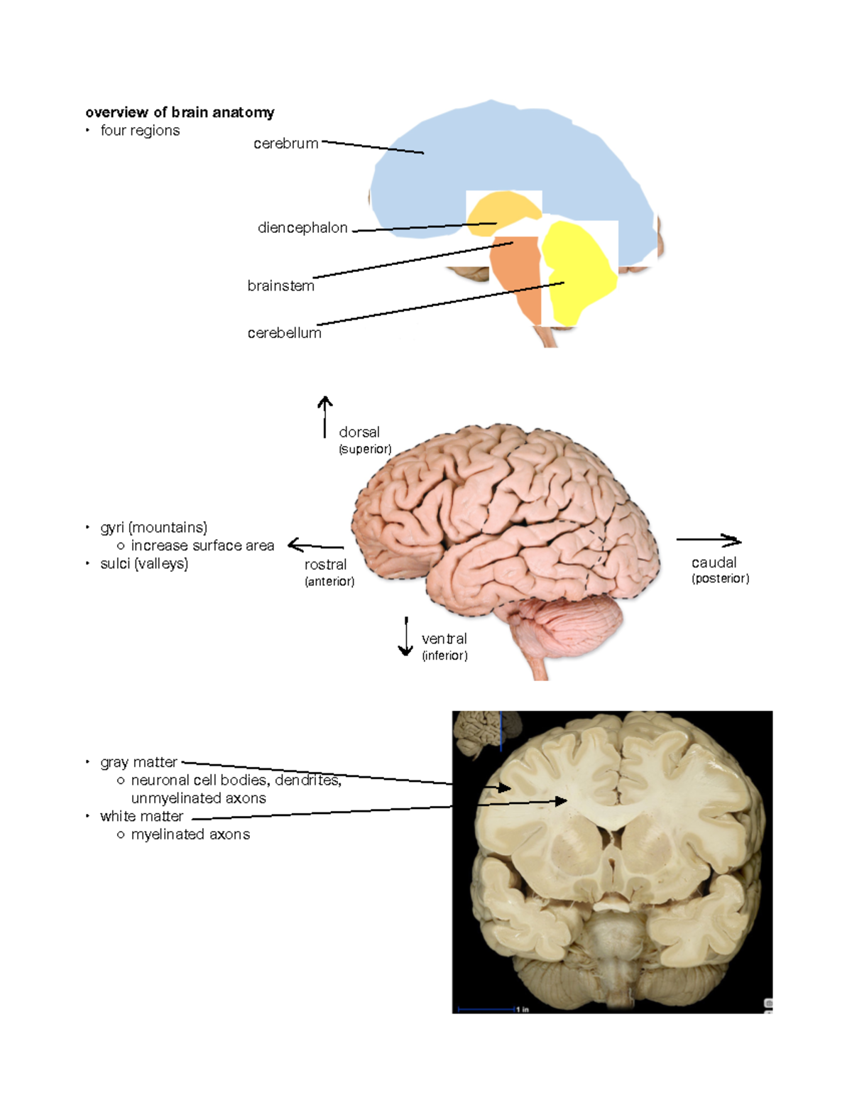 Ch 13 lecture nervous system brain X - overview of brain anatomy four ...