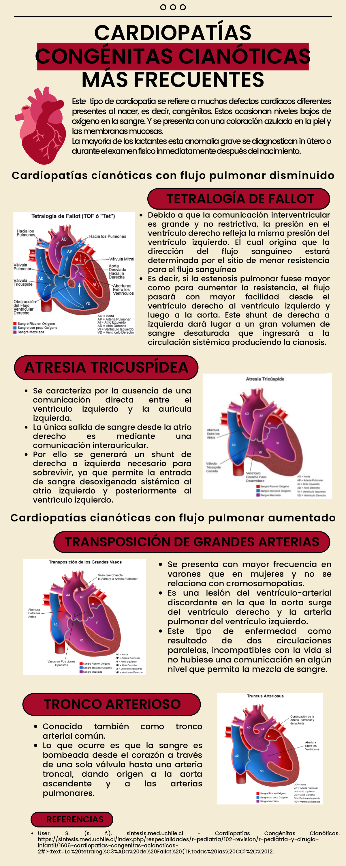 Infografía de Cardiopatía cianótica - TETRALOGÍA DE FALLOT TRONCO ...