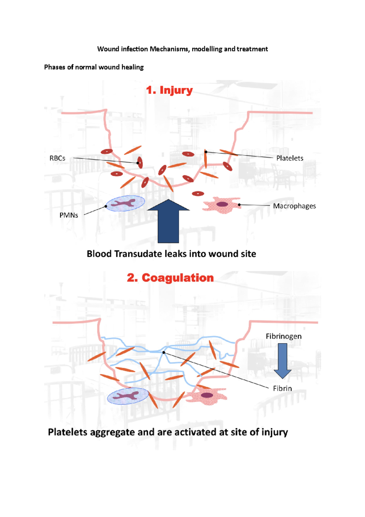 Wound infection Mechanisms - epidermidis S. aureus Streptococcus spp ...