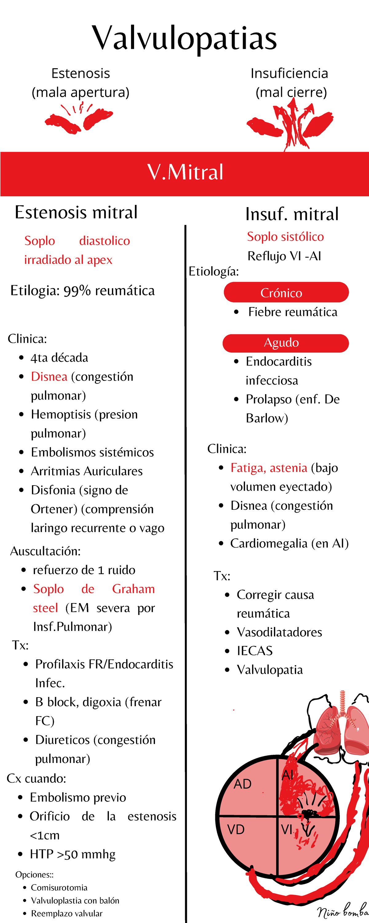Valvulopatias de la válvula Mitral - Estenosis (mala apertura ...